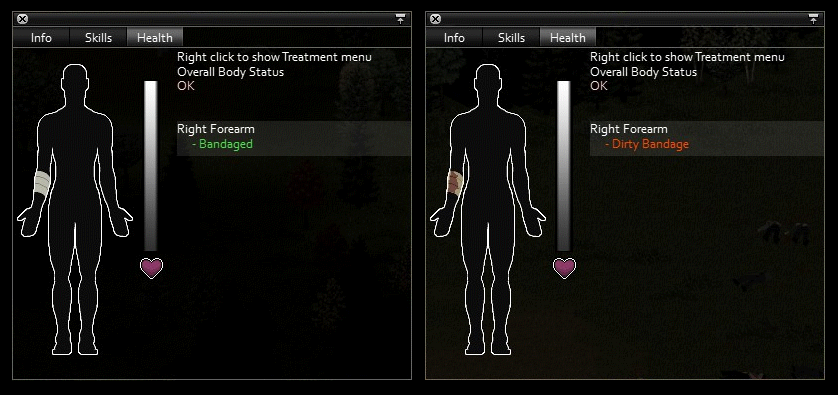 Steam Community :: Guide :: PZ Skill - First Aid